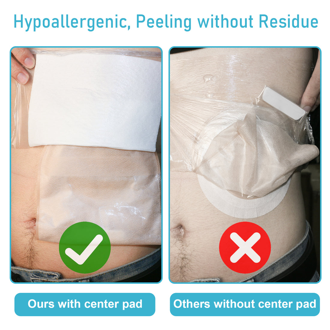 25 Pcs Waterproof Ostomy Bag Shower Cover 10"x10", Stoma Bath Protecto ...