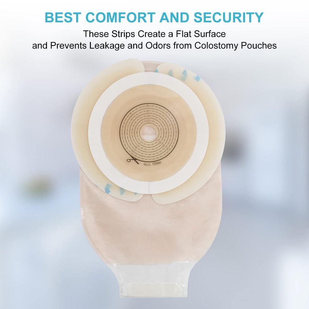 Ostomy Barrier Strips for Colostomy Bags, Elastic (Variety of Styles ...
