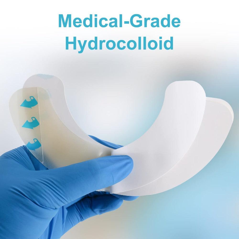 20/40 Pcs Elastic Colostomy Barrier Strips | Medical Grade Hydrocolloi ...